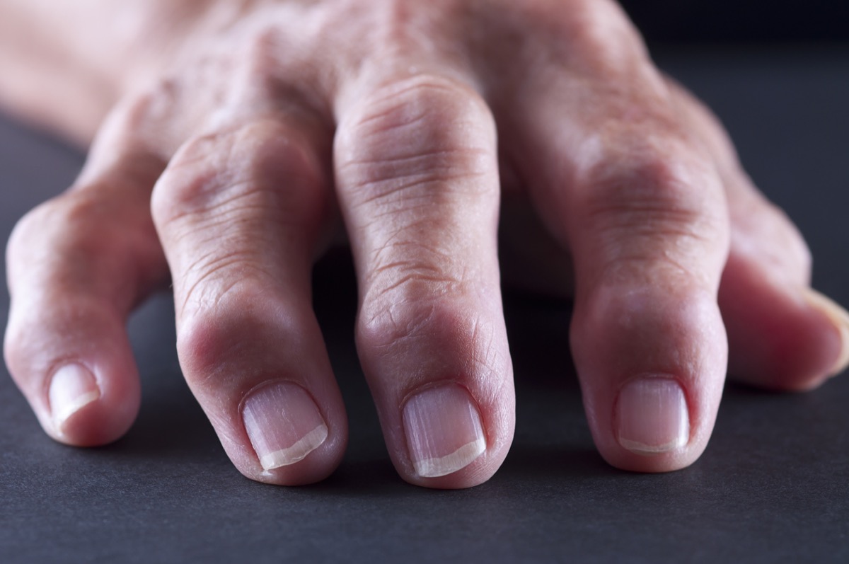 21 Hand Symptoms That Indicate Bigger Health Problems