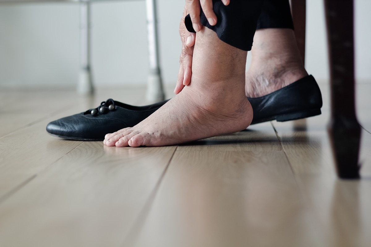25 Signs of Kidney Disease You Can't Afford to Ignore