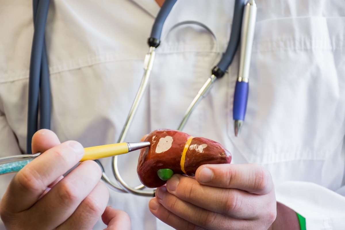 If You Notice This on Your Hands, Get Your Liver Checked, Doctors Say