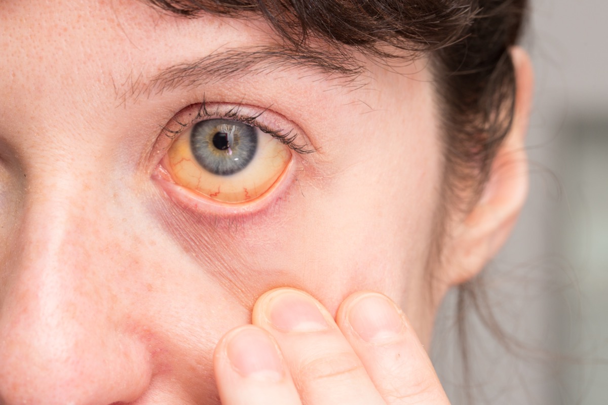 50 Subtle Health Symptoms You Should Never Ignore — Best Life