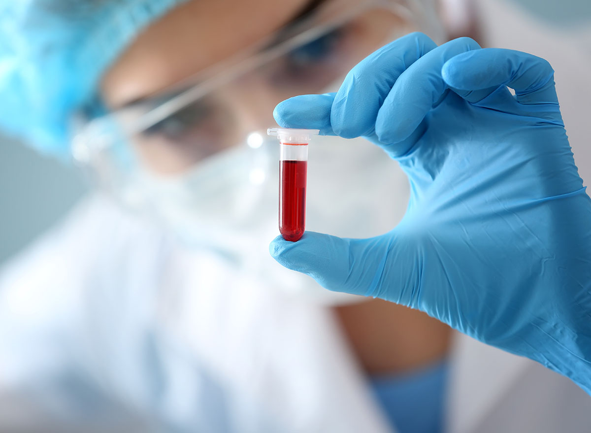 New $3 Blood Test Can Detect Cancer — Best Life