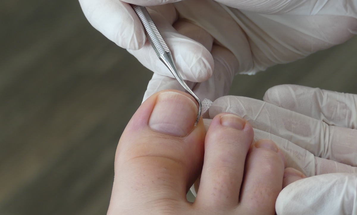 What If You Don't Cut Your Toenails for a Month — Best Life