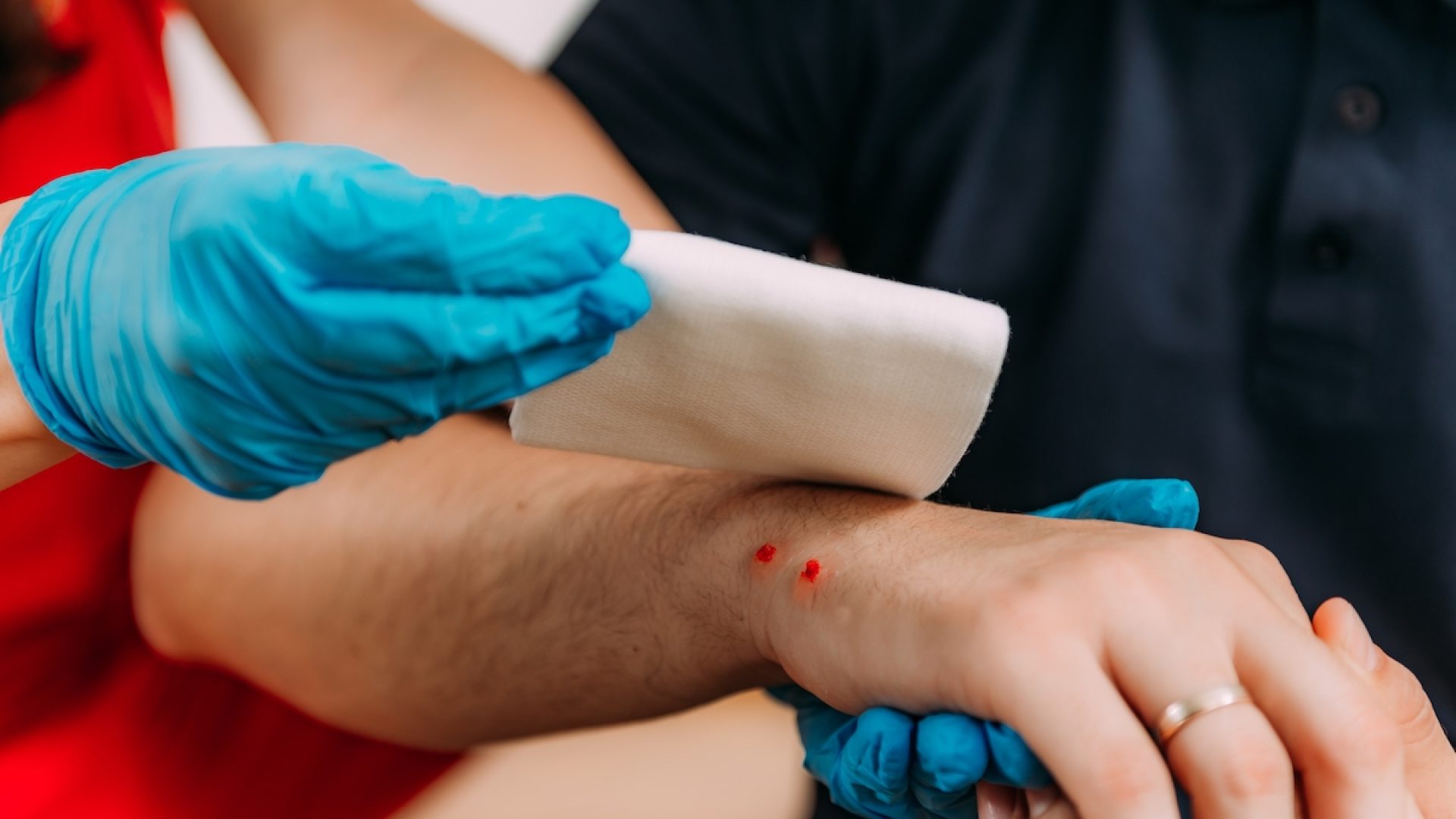 States See Record-Breaking Number of Snake Bites — Best Life