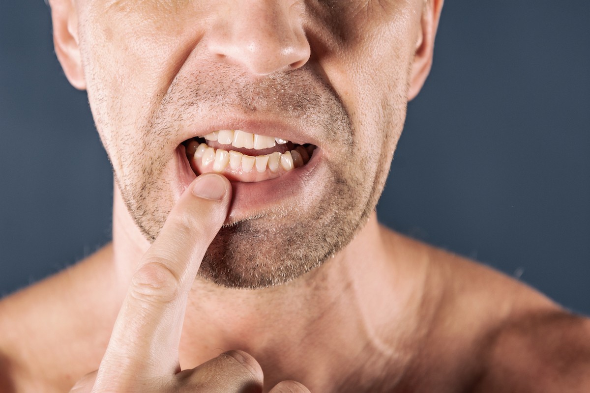 10 Surprising Signs You Have a Vitamin C Deficiency