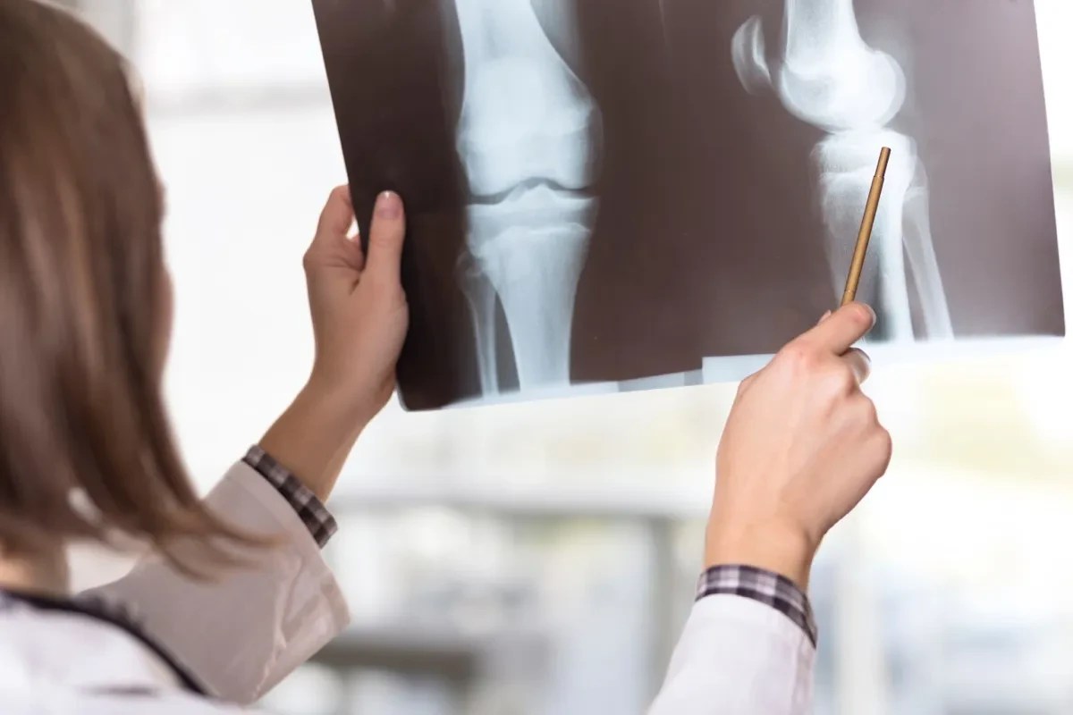 8 Amazing Calcium Benefits, According to Doctors
