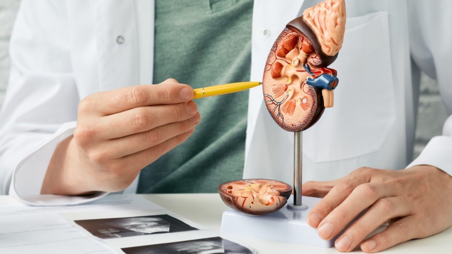 Doctors Say These 8 Supplements Can Damage Your Kidneys