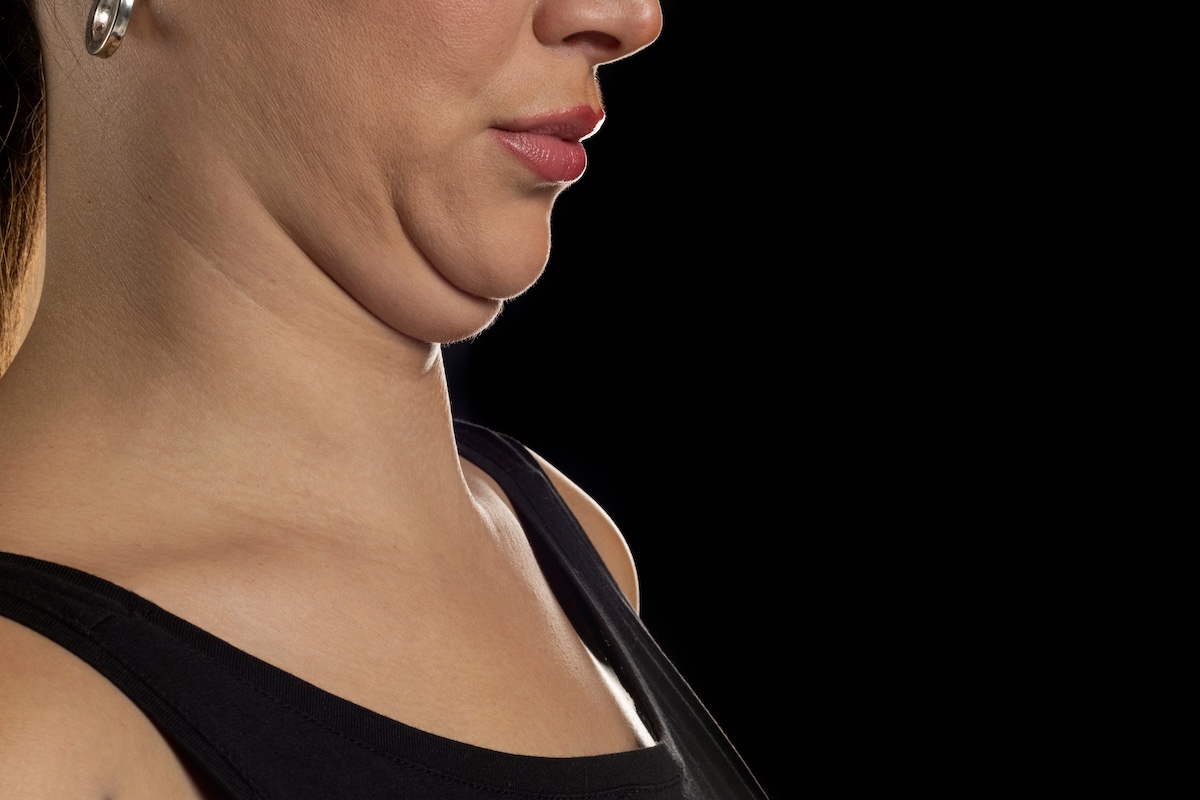 4 Tech Neck Stretches for Instant Relief, Chiropractors Say