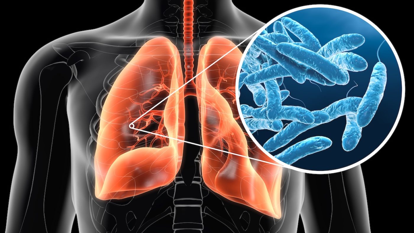 Doctor Issues Warning About Rising Legionnaires' Disease Cases — Best Life